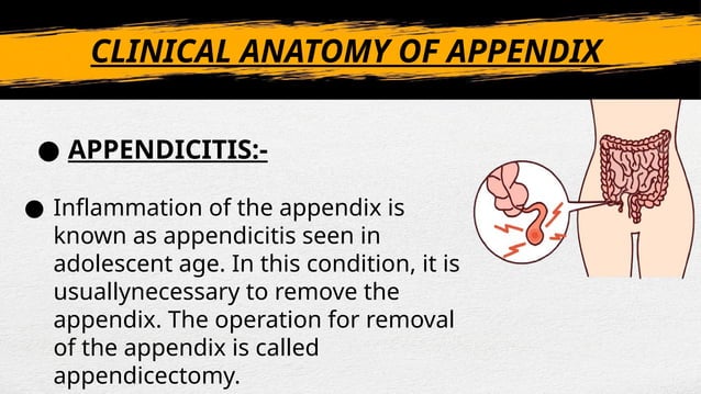 VERMIFORM APPENDIX (GP 10).pptx with detailed diagrams | PPT