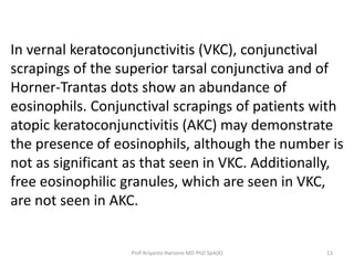 Vernal conjunctivitis | PPT