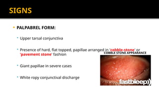vernalkerato....conjunctivitis-140909185523-phpapp02.pptx