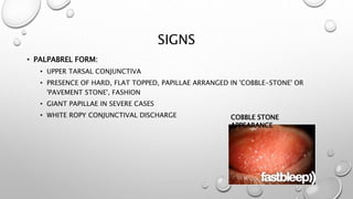 Vernal keratoconjunctivitis ophthalmology | PPTX