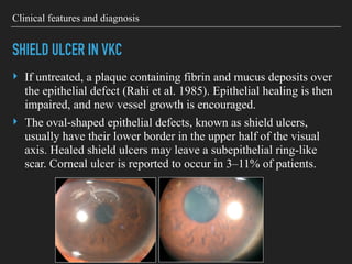 Shield Ulcer