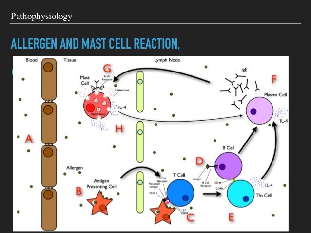 Vernal keratoconjunctivitis