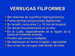 Verrugas | PPT