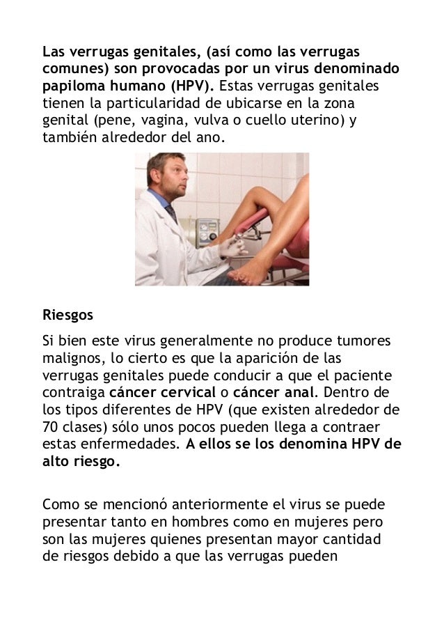 Verrugas Genitales En Hombres Vph En Hombres Causas