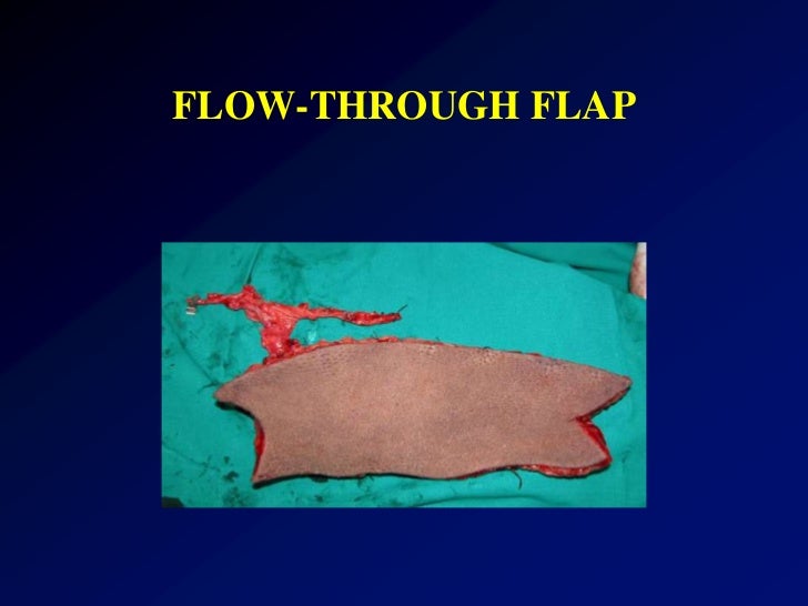 Versatility of anterolateral thigh free flap n. rajacic md