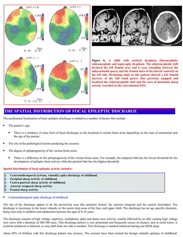 Issues In Brainmapping Brainmapping And Focal Epileptic Disorders Pdf