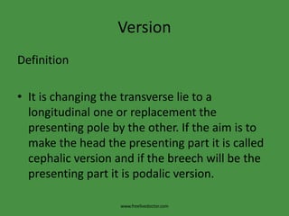 Version | PPT