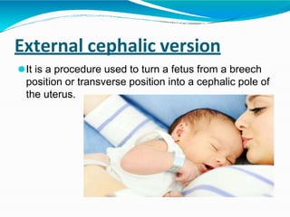 version-180530071824.pptx