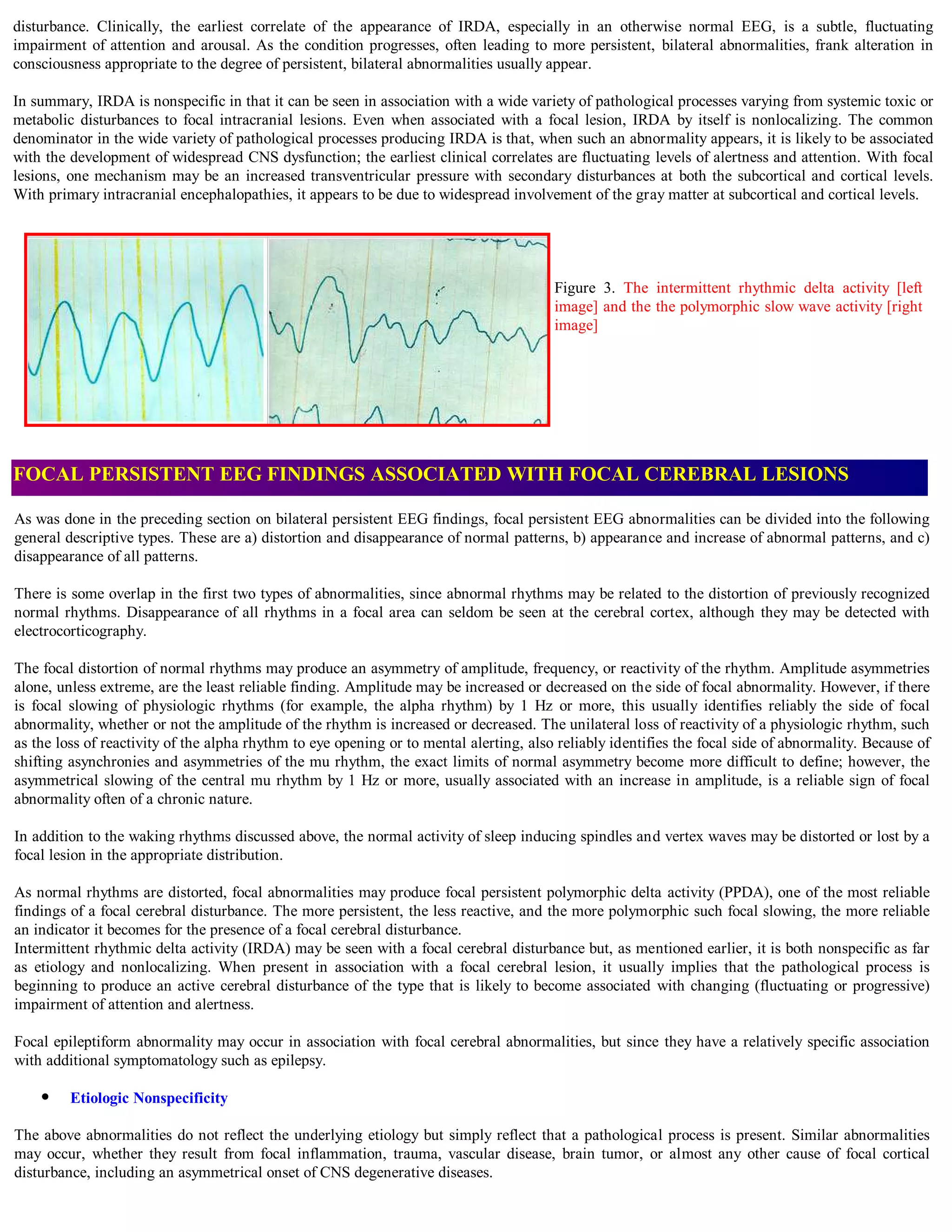 Issues In Brainmapping Nonspecific Eeg Patterns Pdf