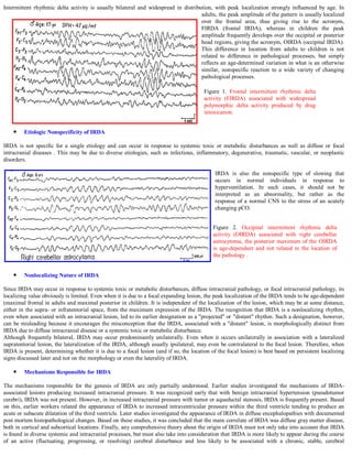 Issues in brainmapping...Nonspecific EEG patterns | PDF