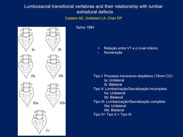 Vertebra de transição lombo-sacra | PPT