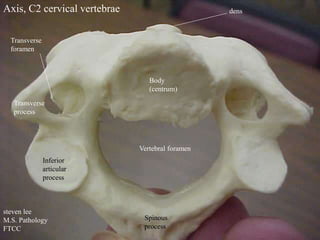 vertebrae.ppt