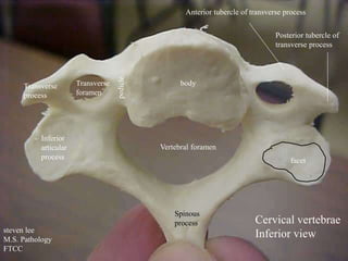 vertebrae.ppt