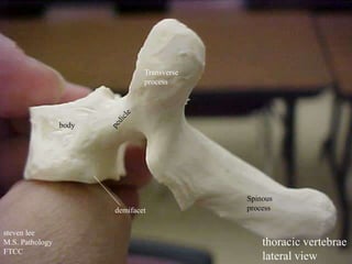 vertebrae.ppt
