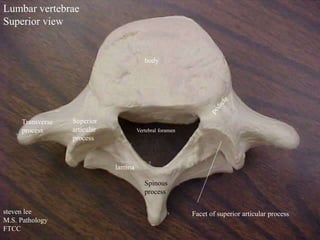 vertebrae.ppt