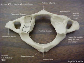 vertebrae.ppt