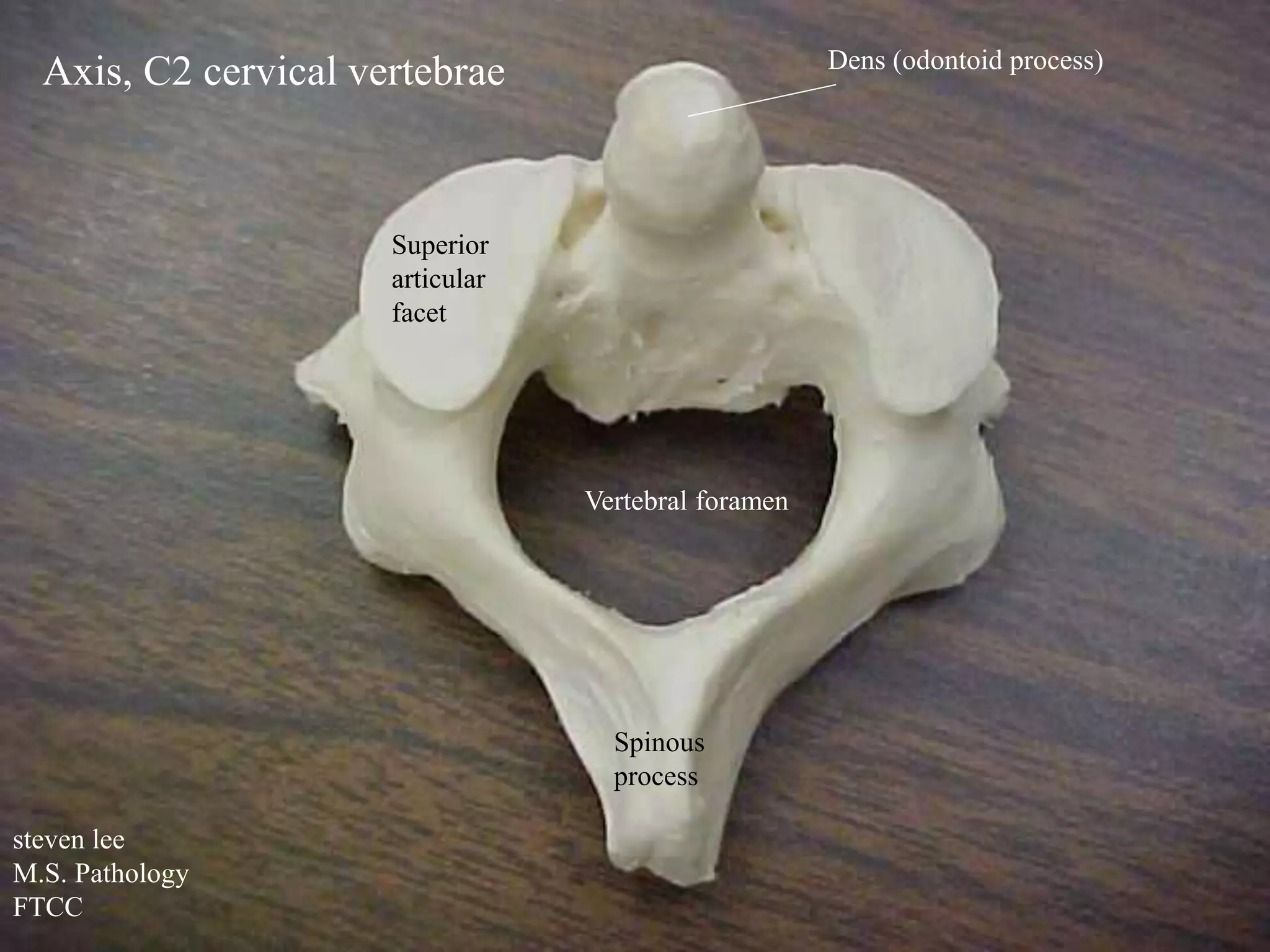 vertebrae.ppt