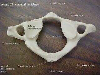 vertebrae.ppt