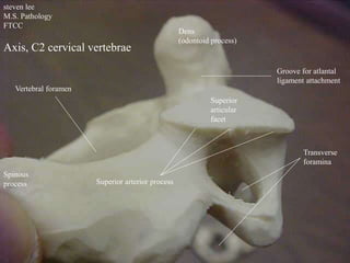 vertebrae.ppt