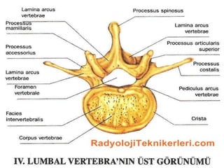 Vertebralar | PPTX