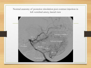 Vertebral Artery Anatomy with Endovascular.pptx
