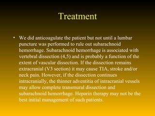 Vertebral artery dissection | PPT