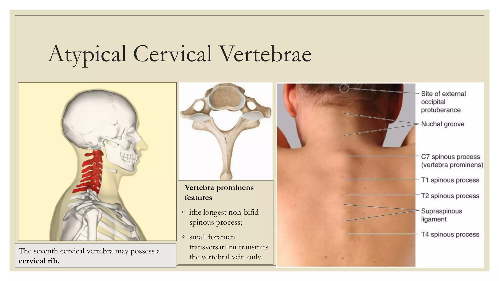 Vertebral column | PPTX