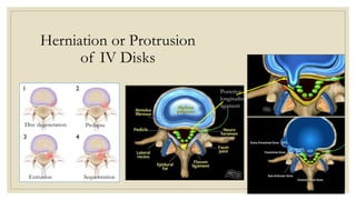 Vertebral column | PPTX