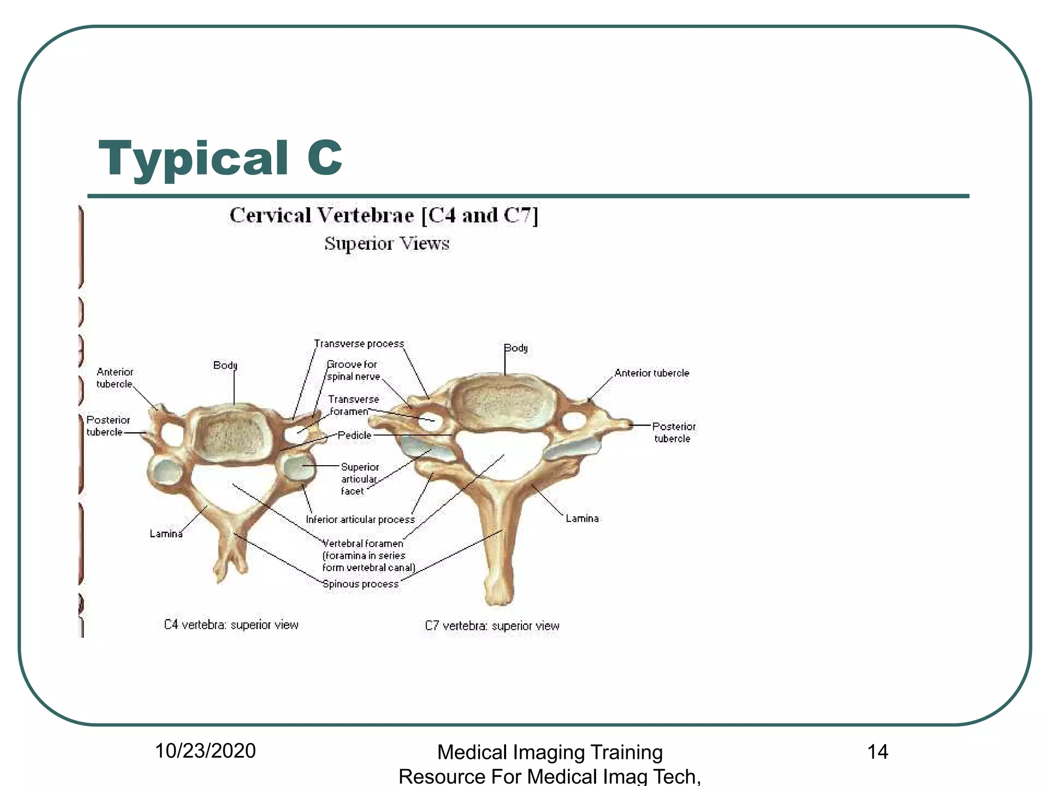 Vertebral column anatomy . radiology training resource ncchanji nkeh ...