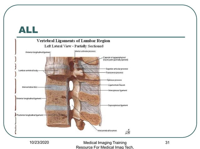 Vertebral column anatomy . radiology training resource ncchanji nkeh keneth | PPT