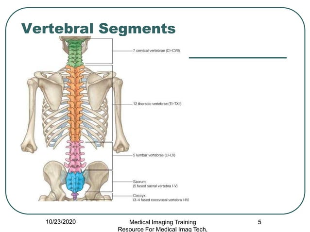 Vertebral column anatomy . radiology training resource ncchanji nkeh ...