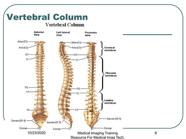 Vertebral column anatomy . radiology training resource ncchanji nkeh keneth | PPT