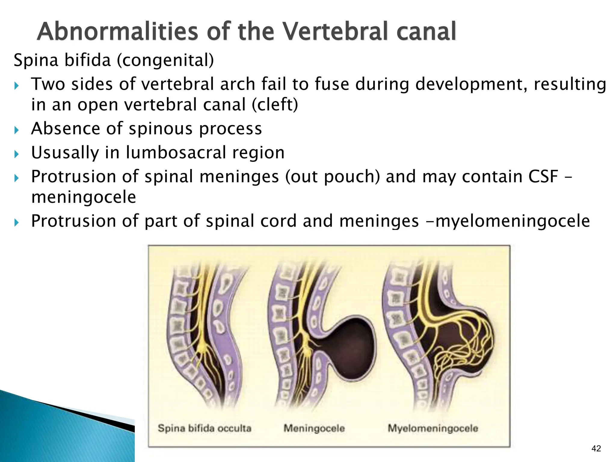 Vertebral Column Anatomy and Embryology At a glance | PPT