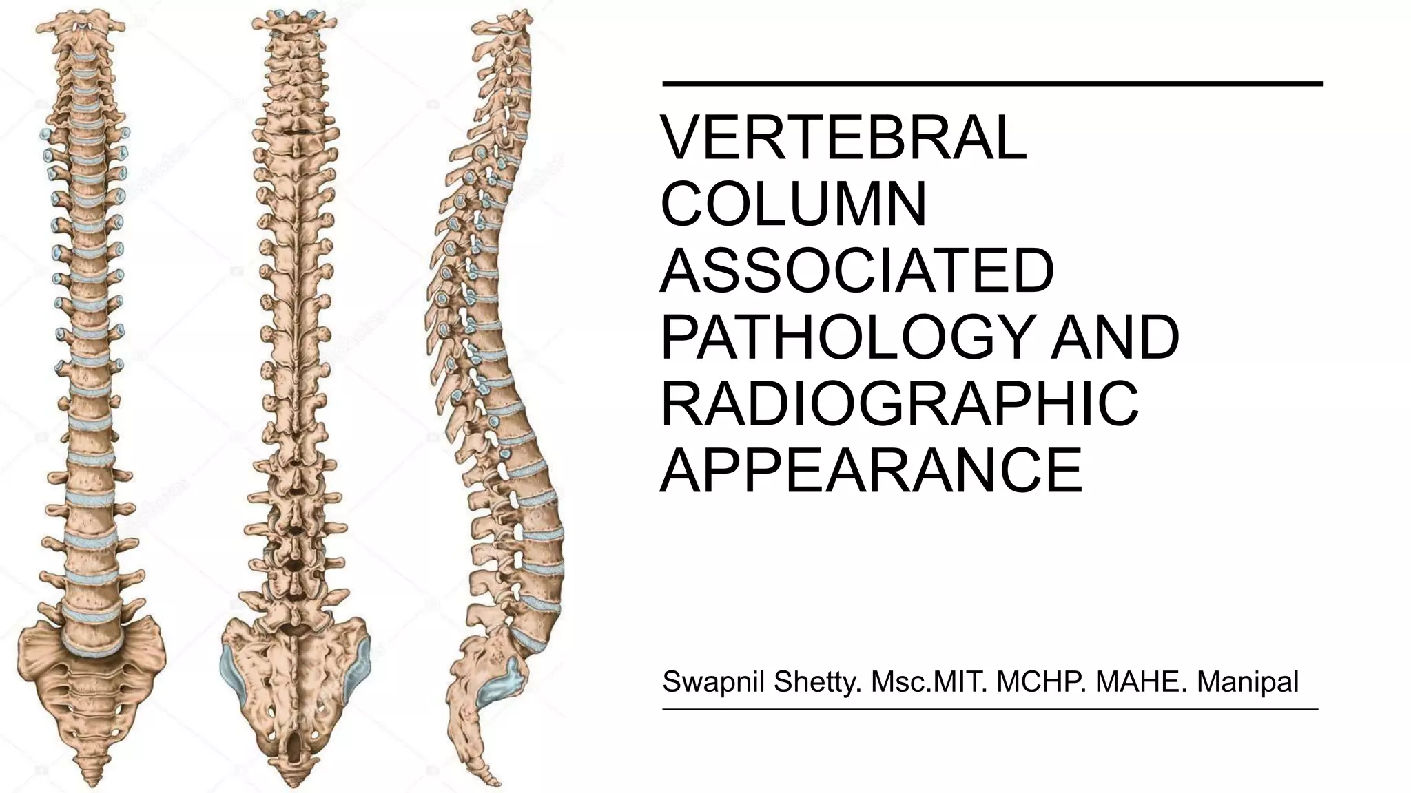 Vertebral column associated pathology and radiographic appearance | PPTX