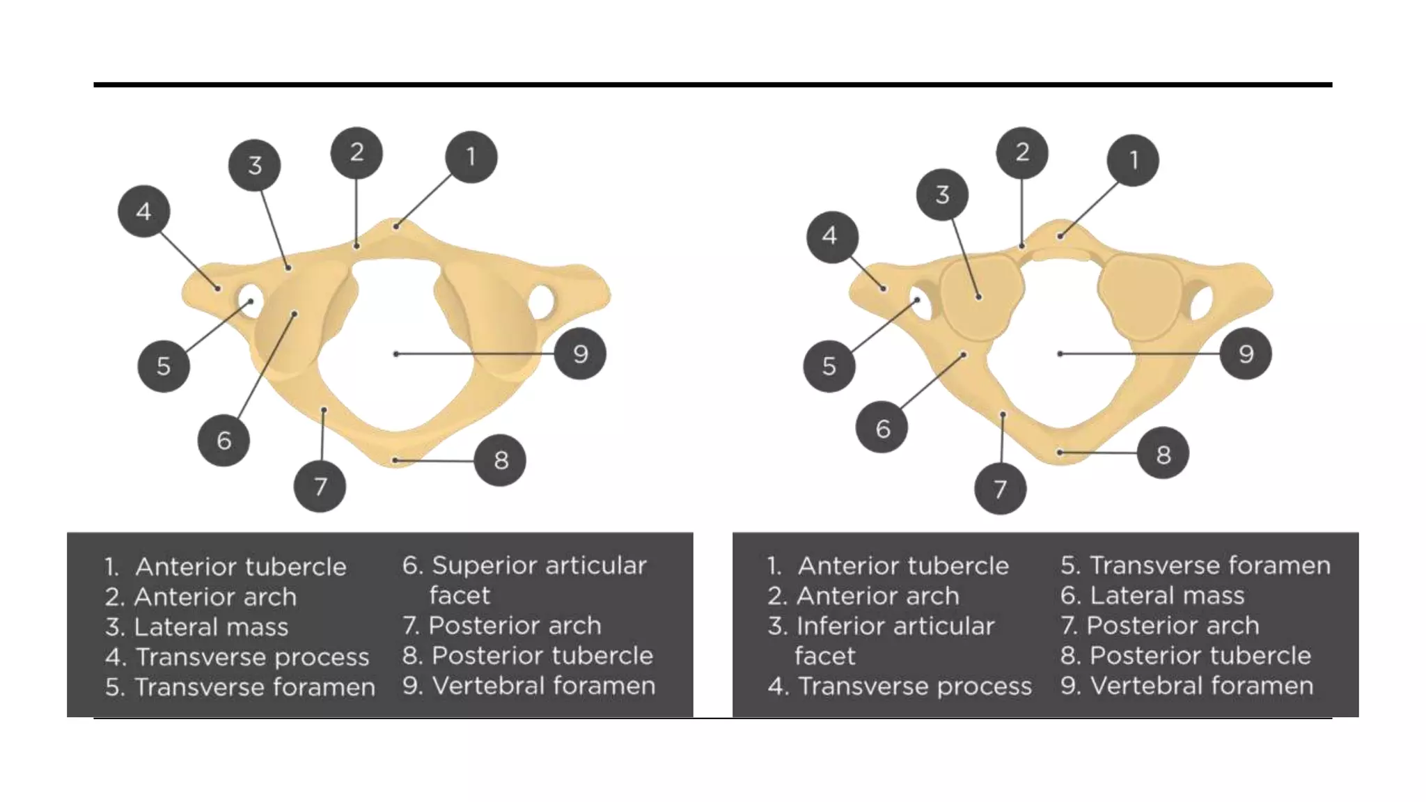 Vertebral column associated pathology and radiographic appearance | PPTX