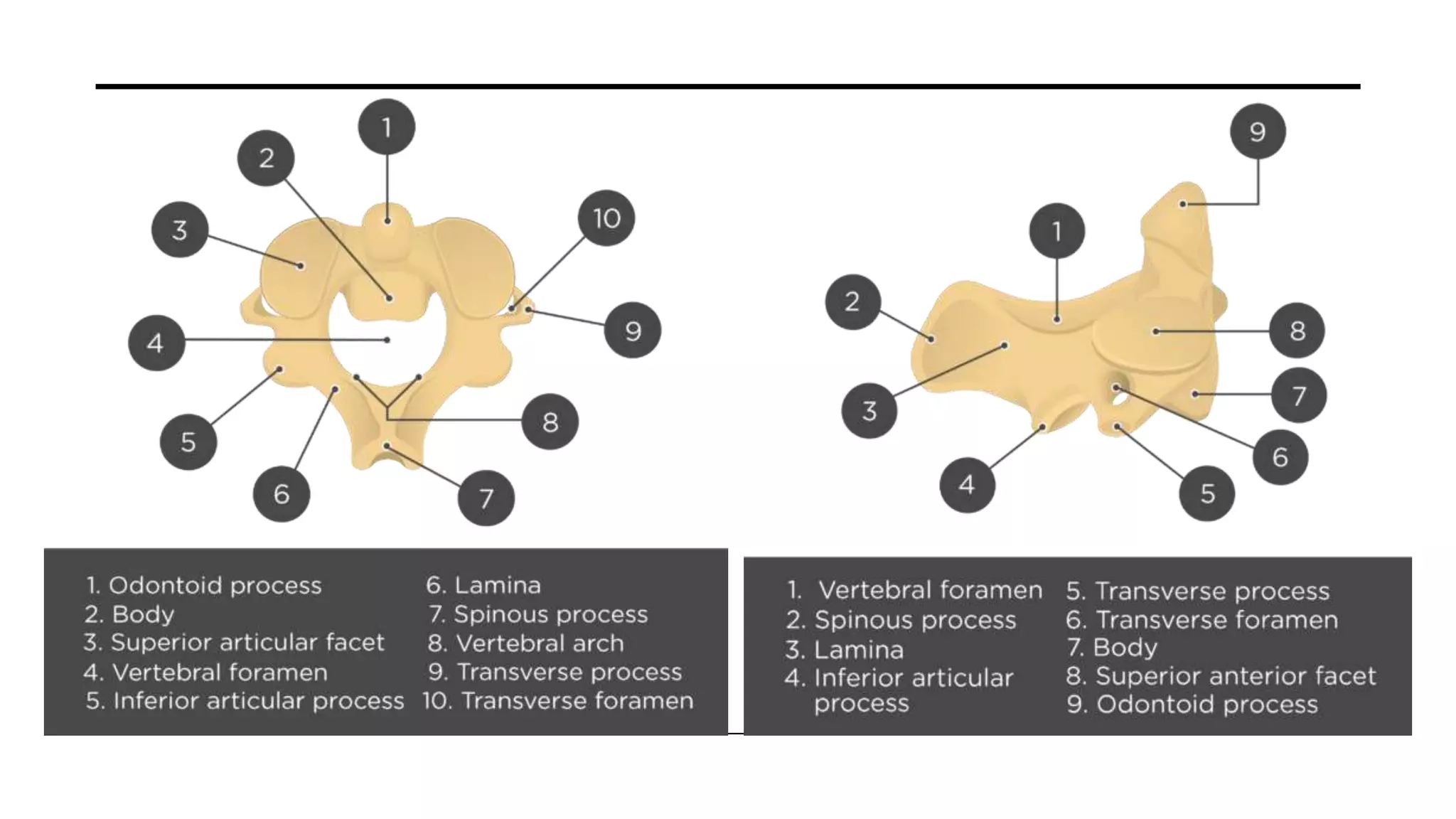 Vertebral column associated pathology and radiographic appearance | PPTX