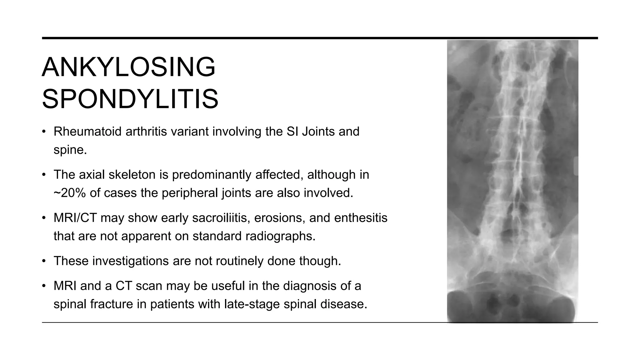 Vertebral column associated pathology and radiographic appearance | PPTX