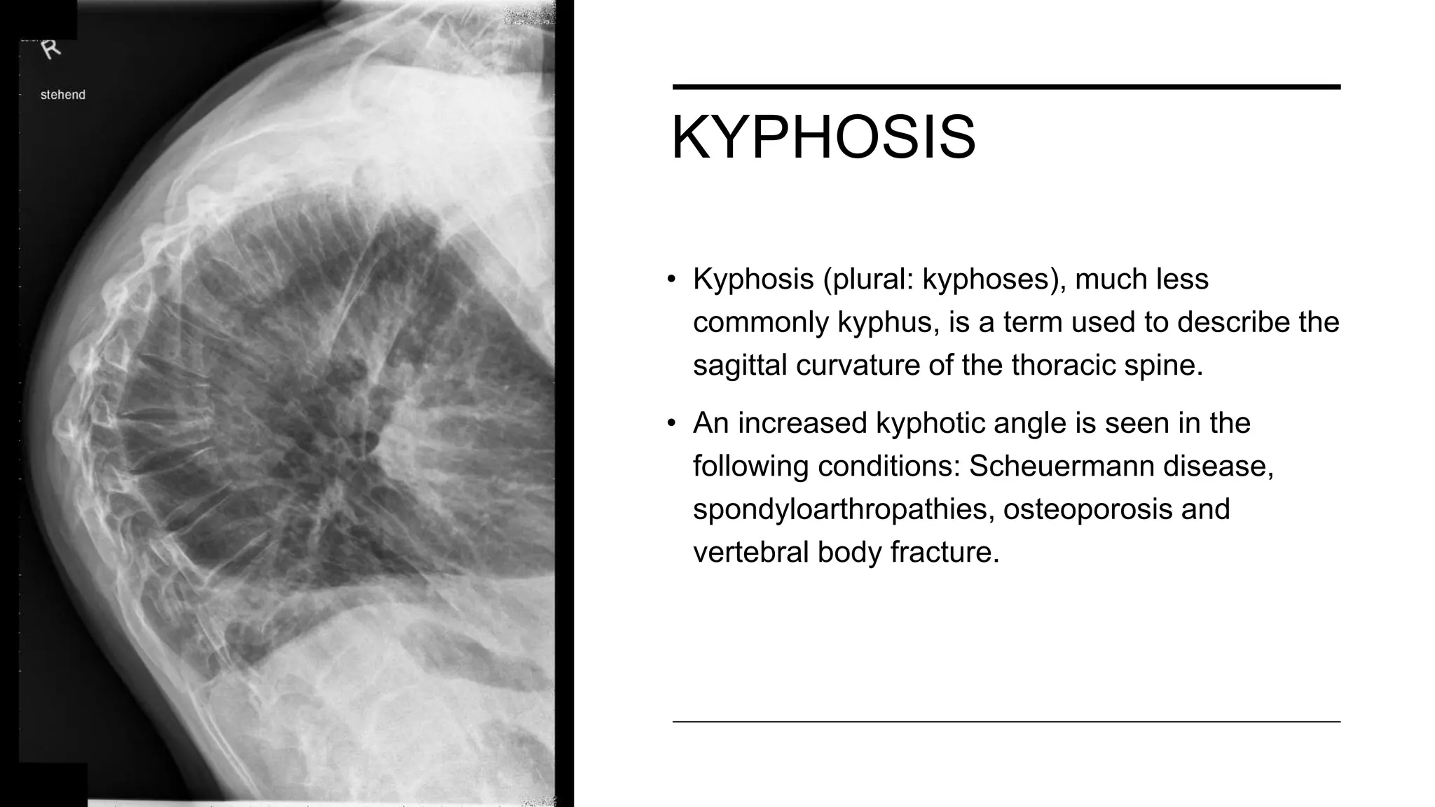Vertebral column associated pathology and radiographic appearance | PPTX