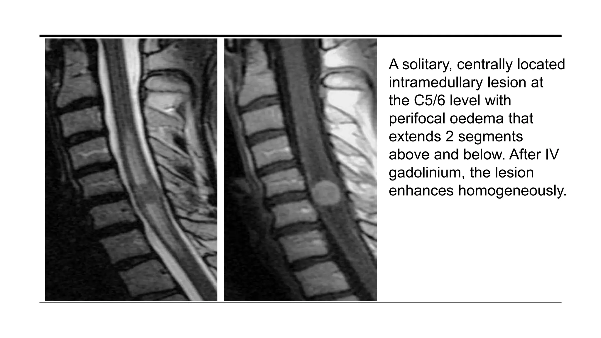 Vertebral column associated pathology and radiographic appearance | PPTX
