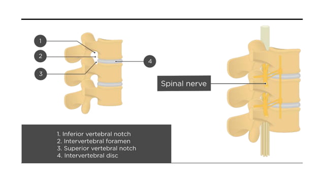Vertebral column associated pathology and radiographic appearance | PPT