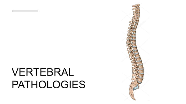 Vertebral column associated pathology and radiographic appearance | PPT