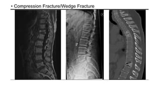 Vertebral column associated pathology and radiographic appearance | PPTX