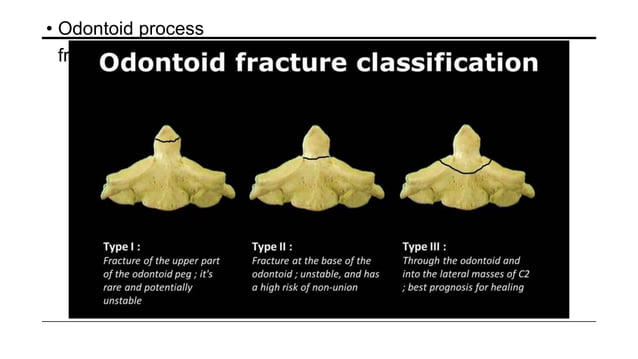 Vertebral column associated pathology and radiographic appearance | PPT