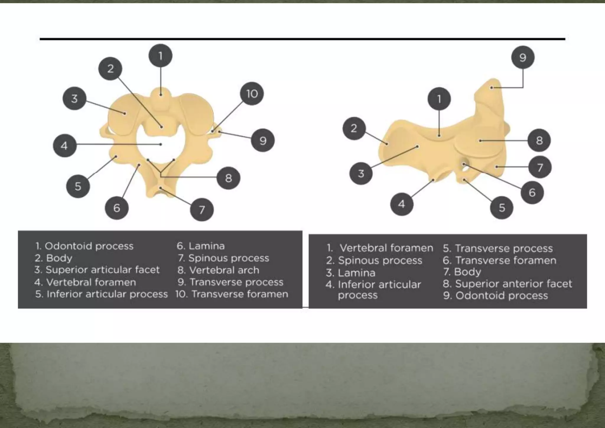 Vertebral column pathology , PPT, | PPTX
