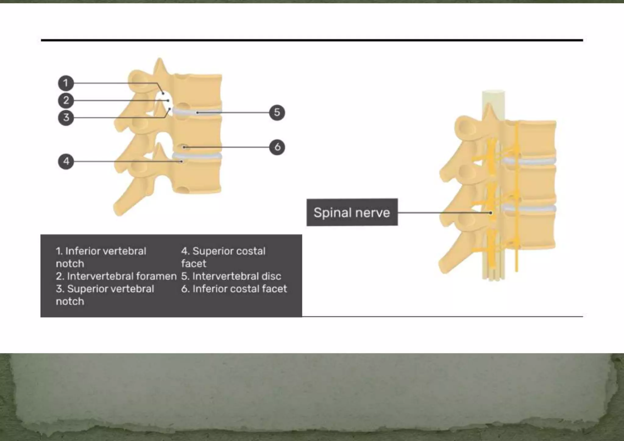 Vertebral column pathology , PPT, | PPTX