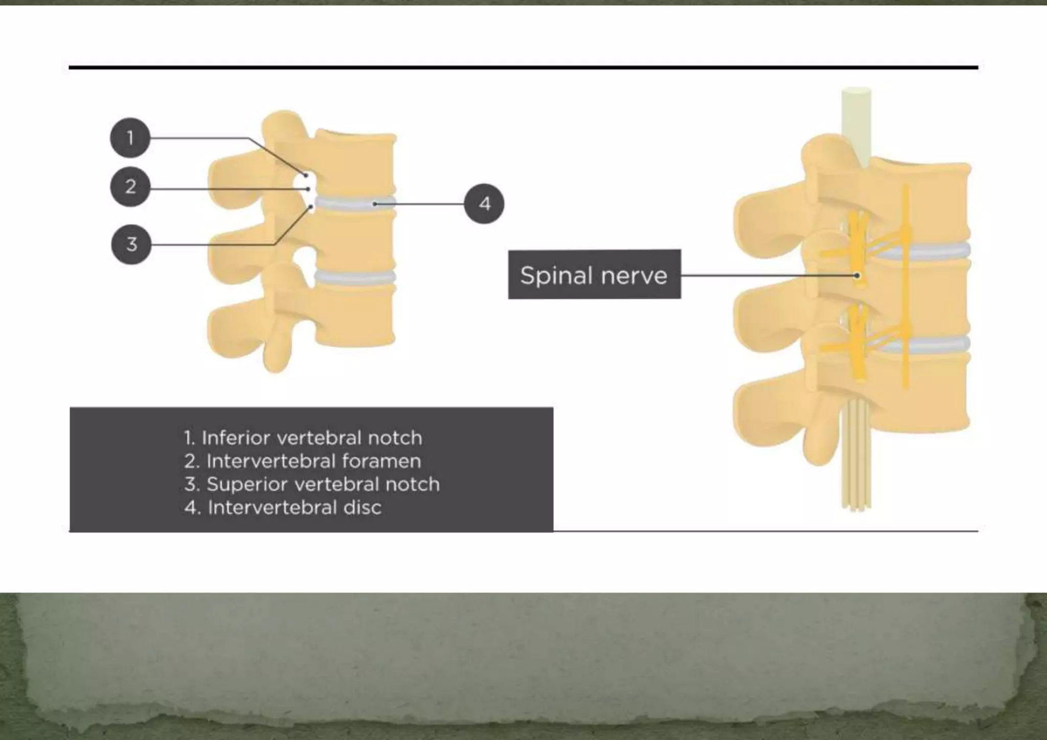 Vertebral column pathology , PPT, | PPTX