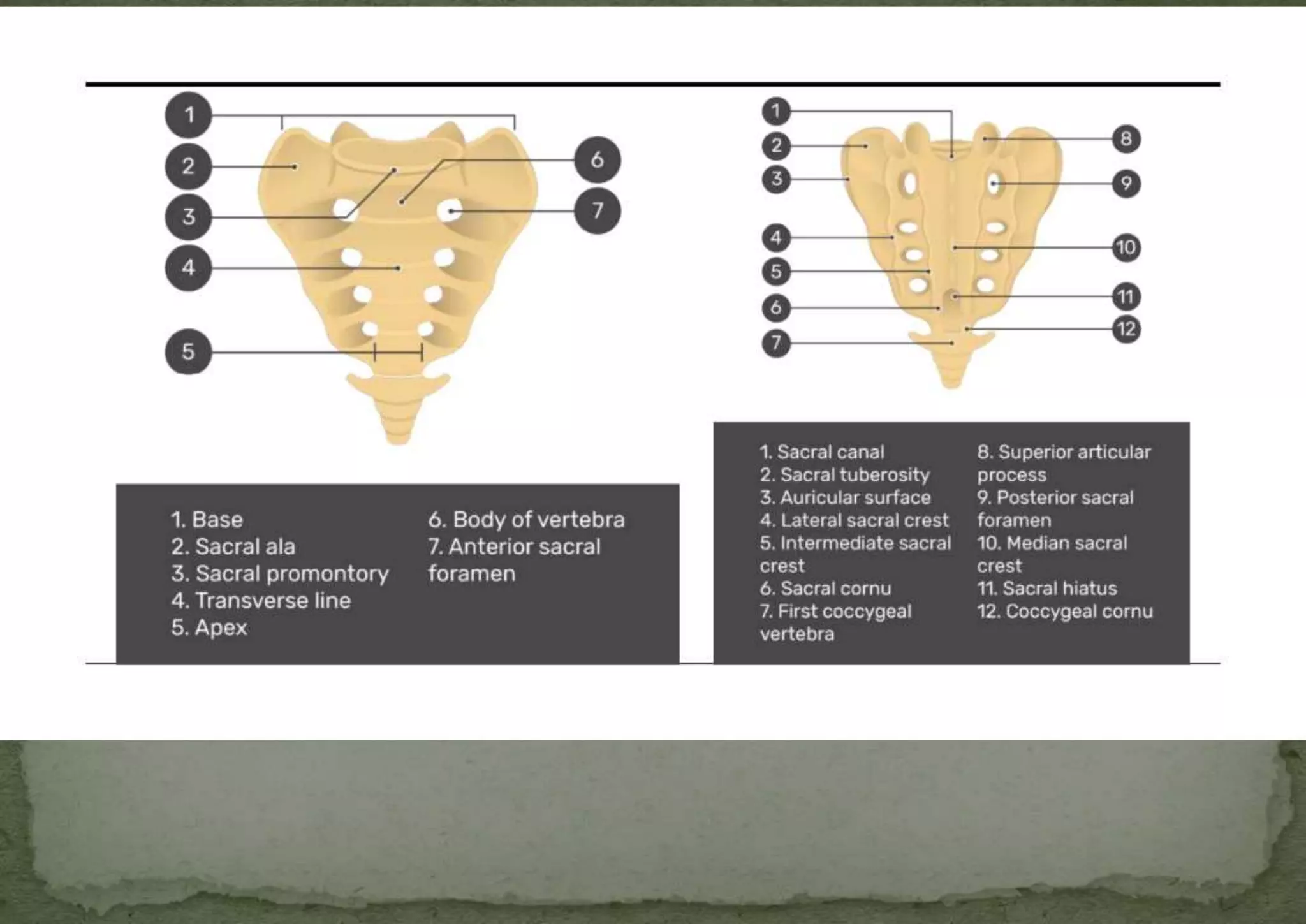 Vertebral column pathology , PPT, | PPTX