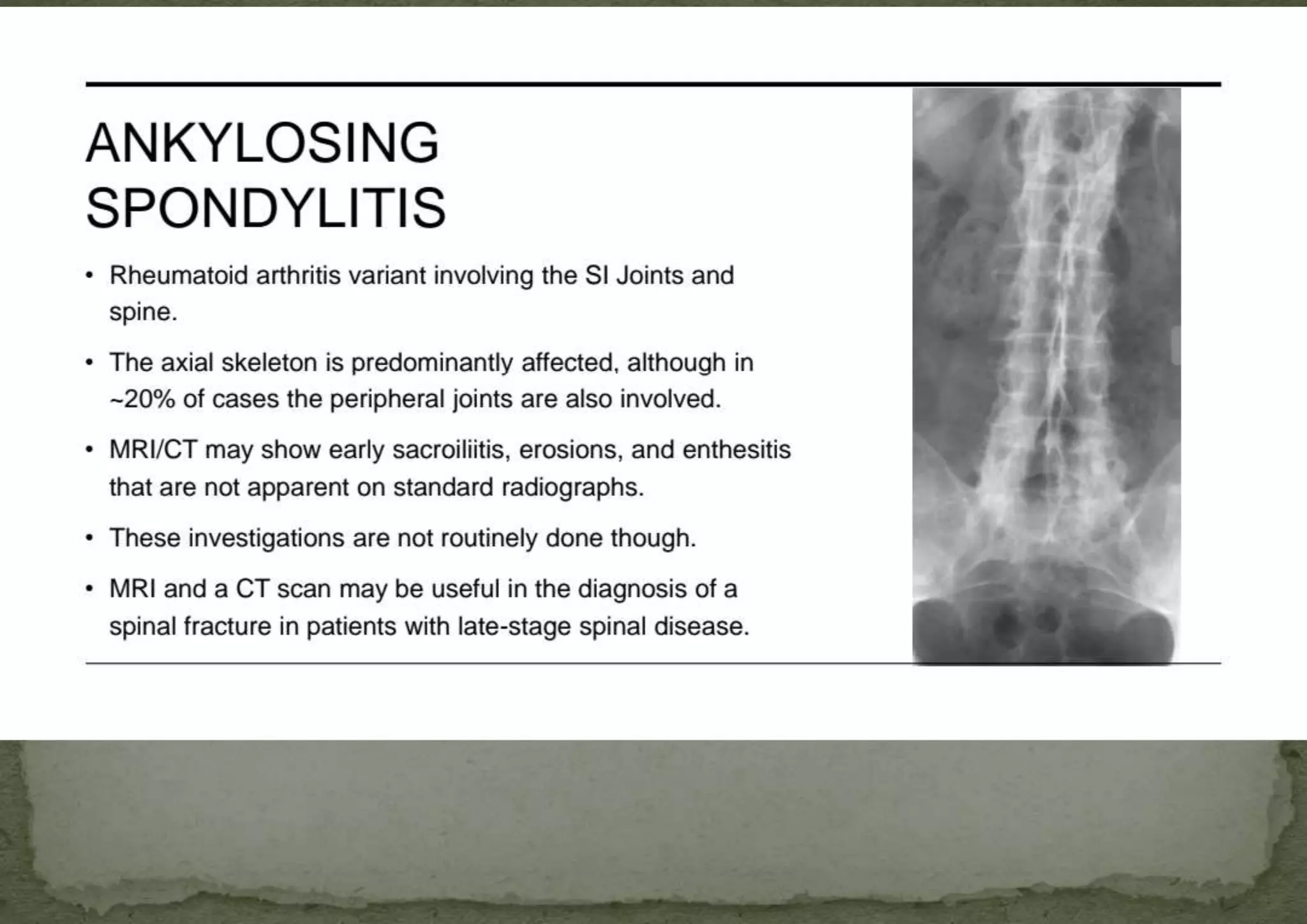 Vertebral column pathology , PPT, | PPTX