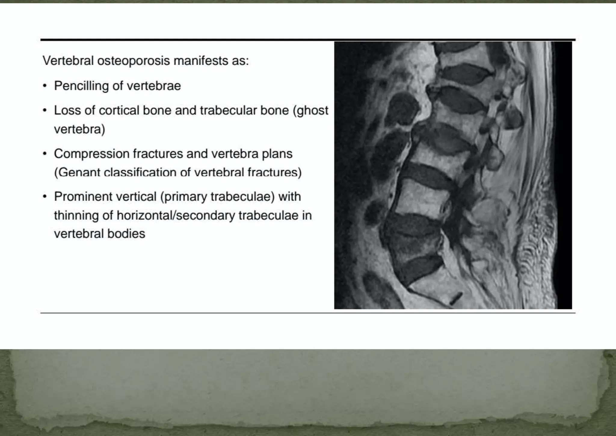 Vertebral column pathology , PPT, | PPTX