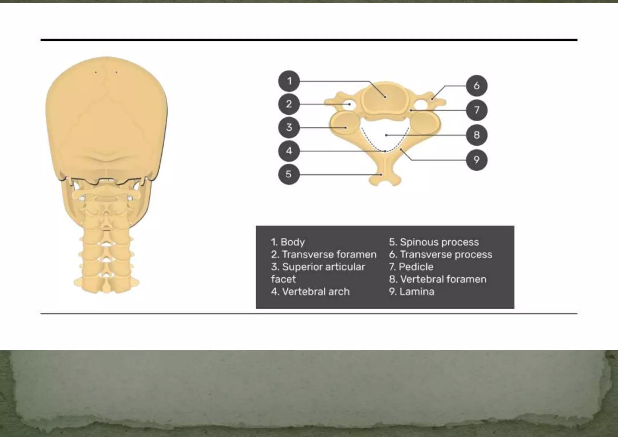 Vertebral column pathology , PPT, | PPTX